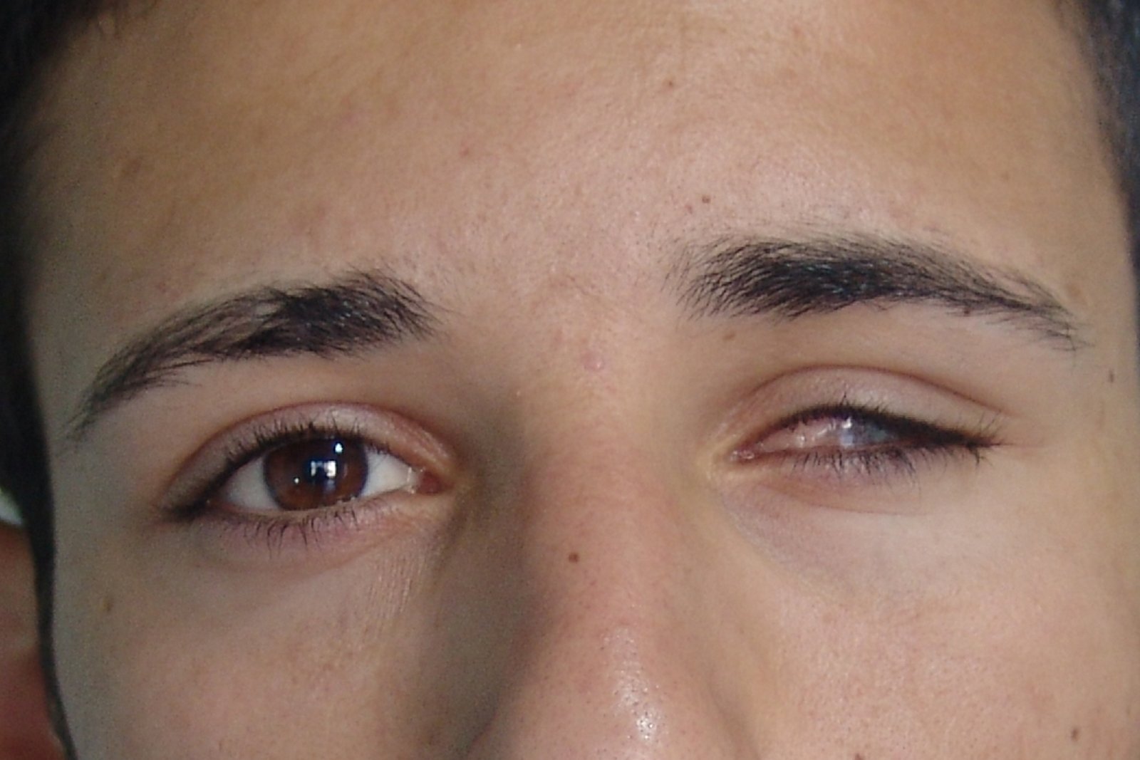 Our Work – The Swiss Lebanese Center for Artificial Eyes